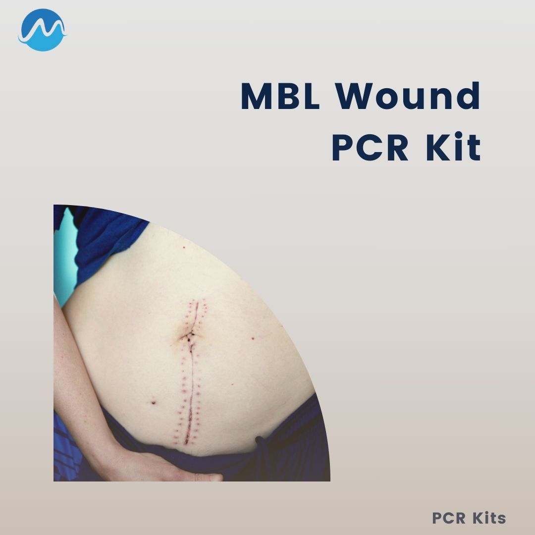 MBL Wound Panel - 100 Rxn/ Kit – MarinaBioLab
